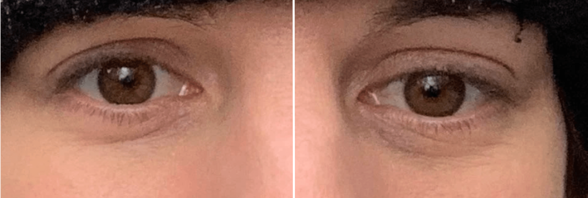 Top 10 Celebrities With Droopy Eyelid - Top Inspired