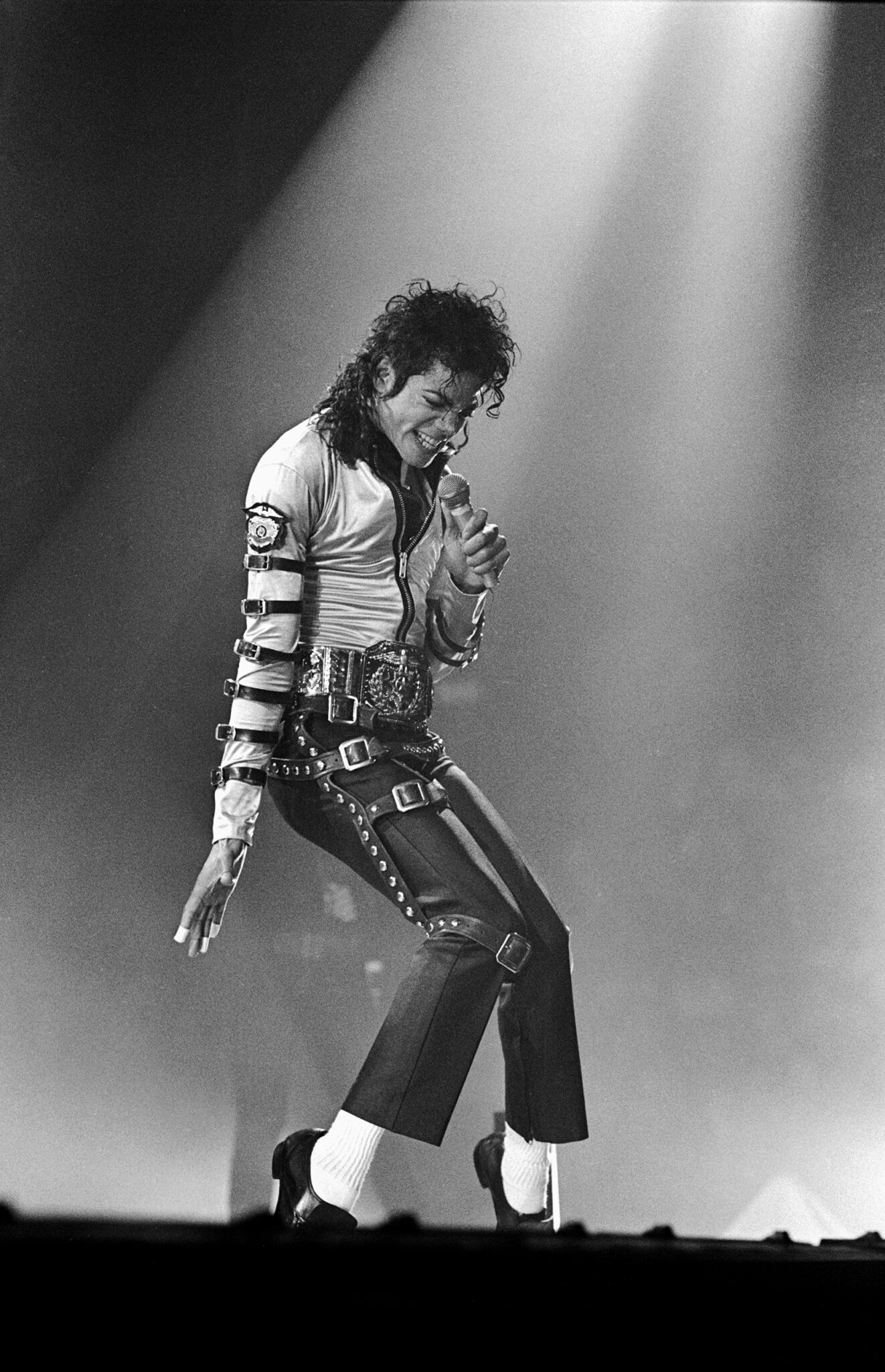 7 Famous People With Vitiligo Who Inspire Millions